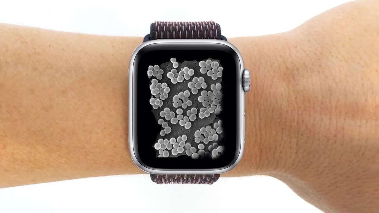 Clean your filthy Apple Watch bands, people