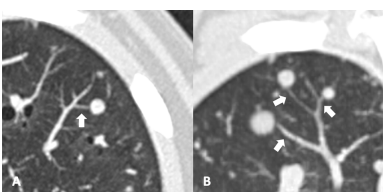 How do you prioritize HSA ddx in dogs?