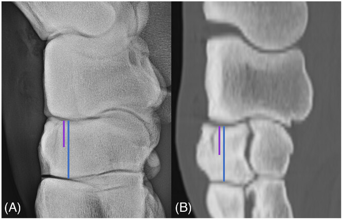 Exploring third carpal bone fractures with CT and rads