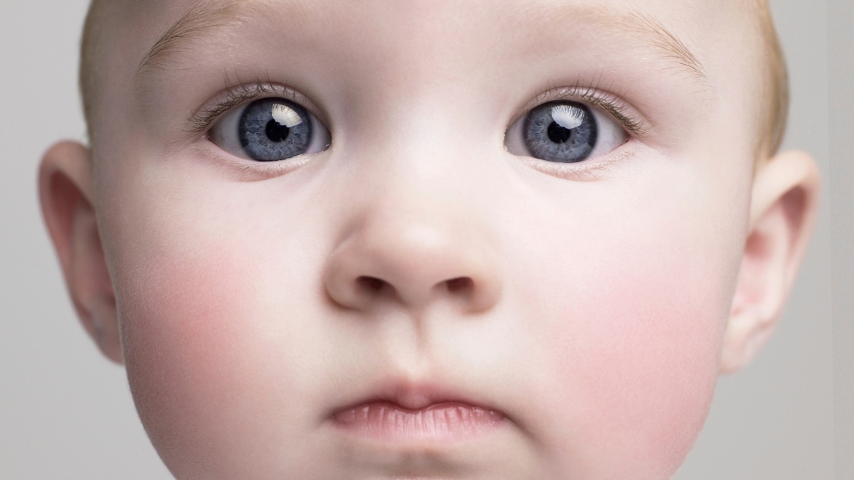 The Roots of Dementia in Childhood