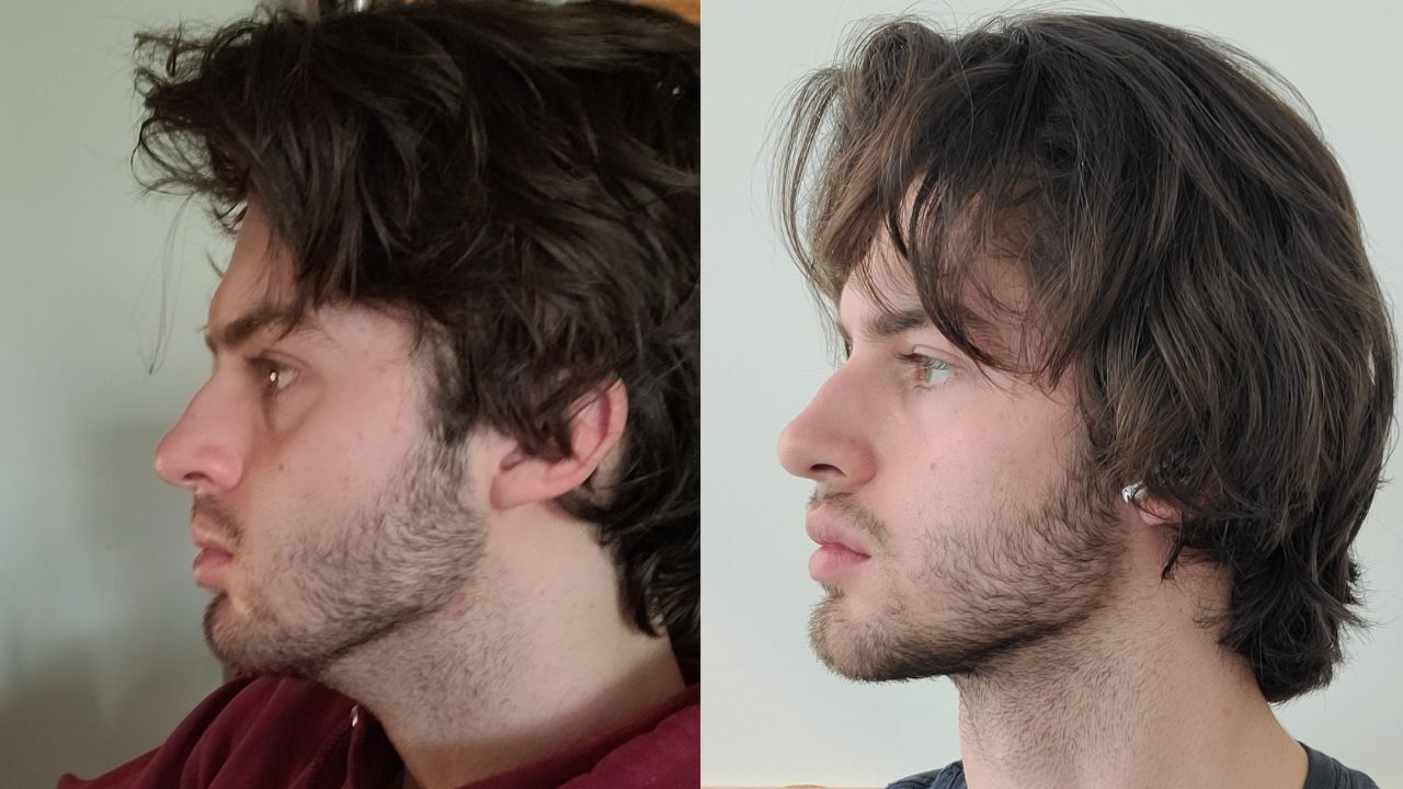 Does Mewing Actually Work?