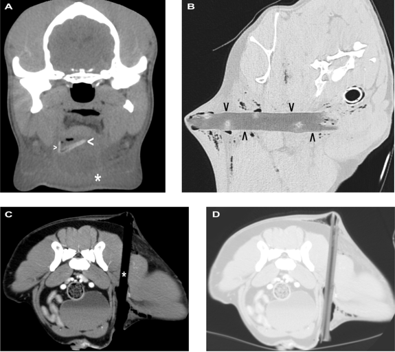 Wood foreign body appearance on CT