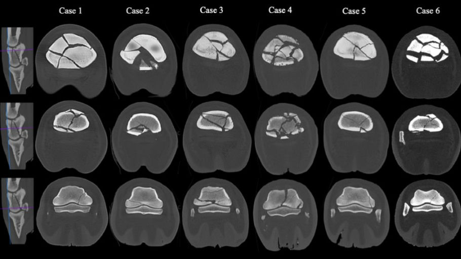 CT Reveals Hidden Fracture Complexity in Warmblood P2 Injuries ...