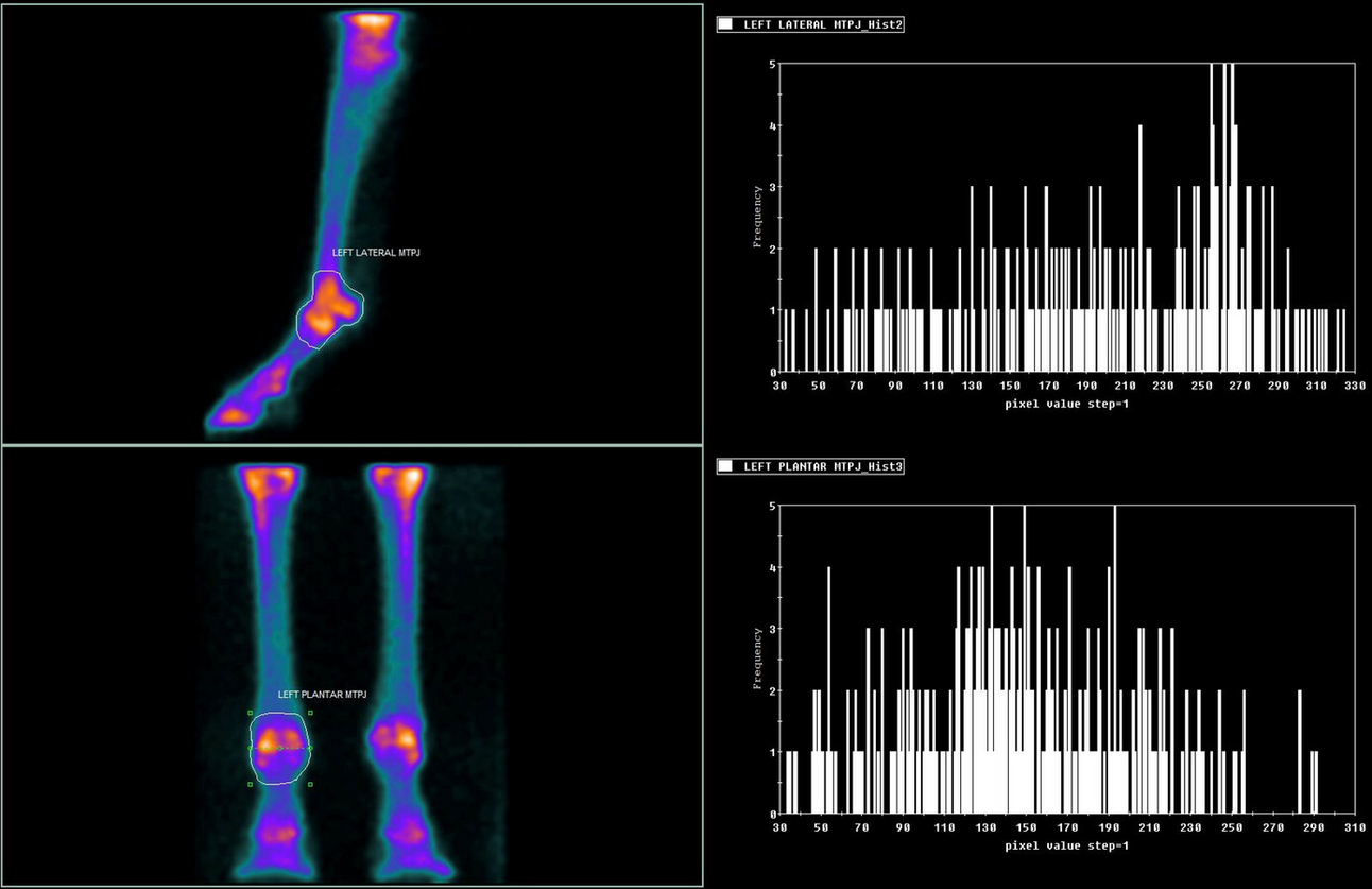 Diagnosing equine musculoskeletal injuries can be aided by serum and ...