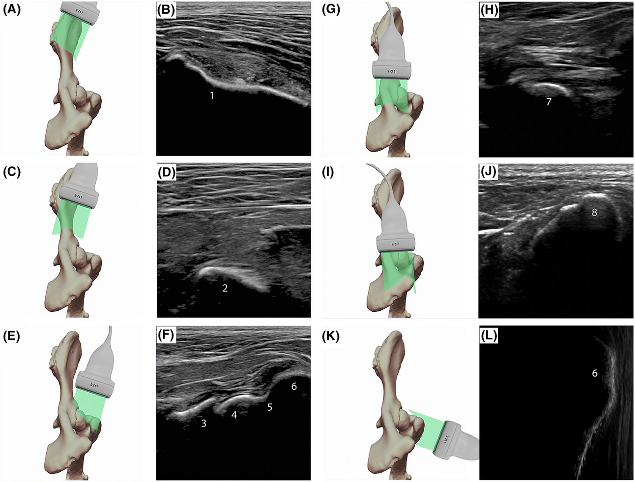 Canine Hip Luxation Diagnosis: Ultrasound vs Radiographs
