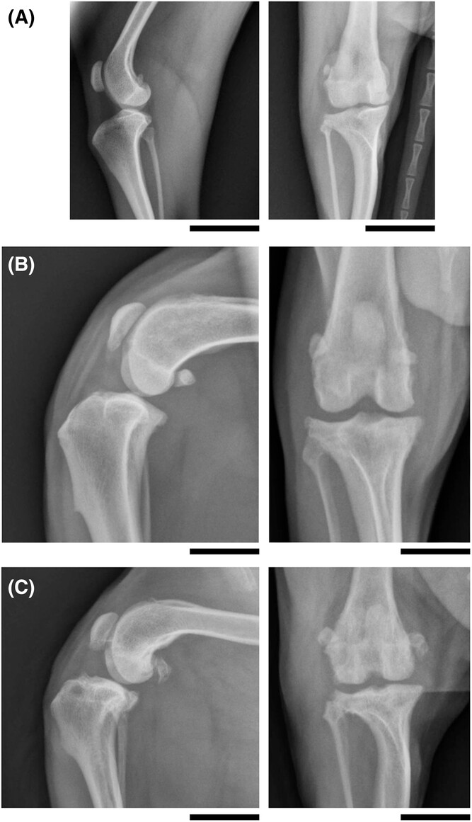 Which causes more OA: CLL rupture or MPL?
