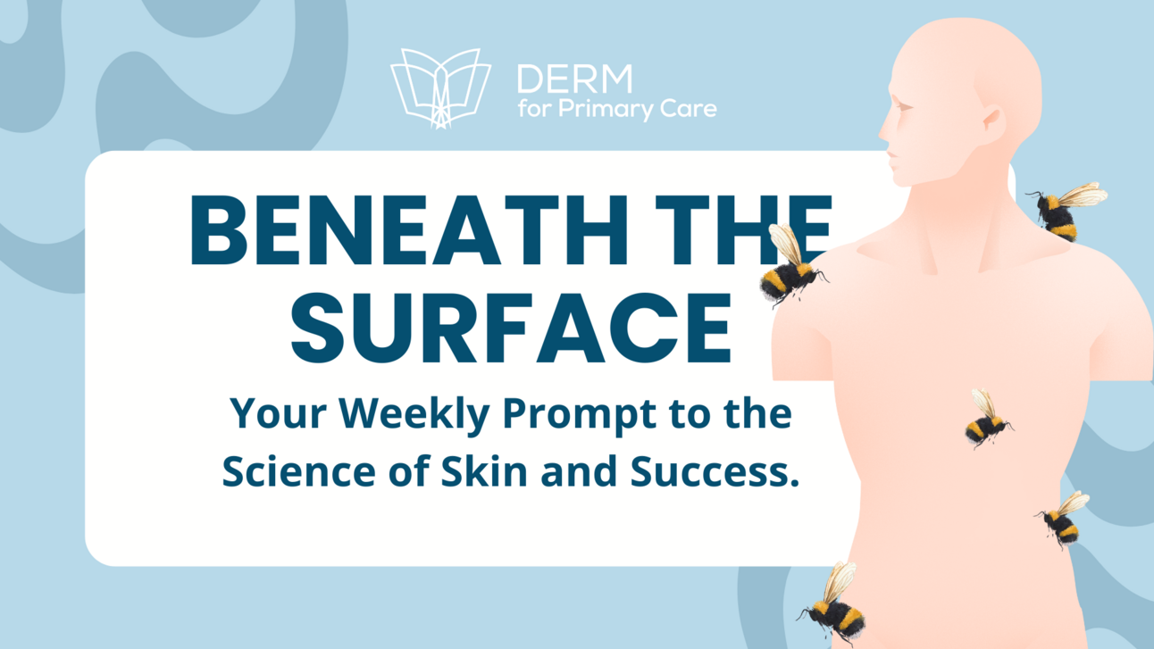 Venomous Stings – What You Need to Know