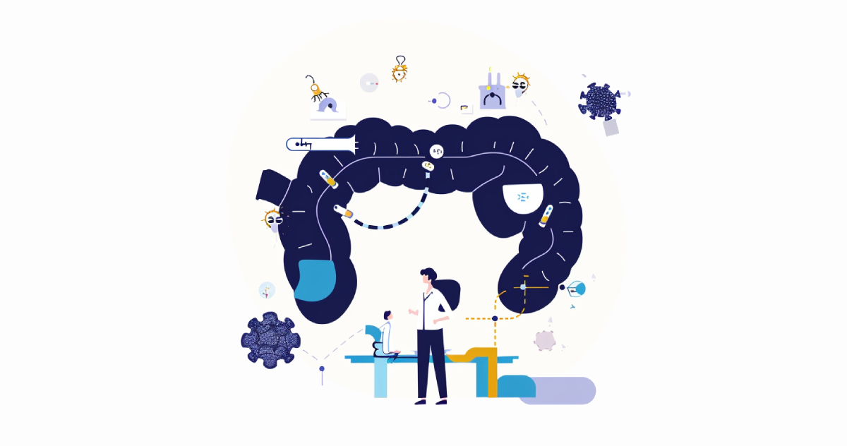 IBD Flare-Ups Predicted Before They Even Start