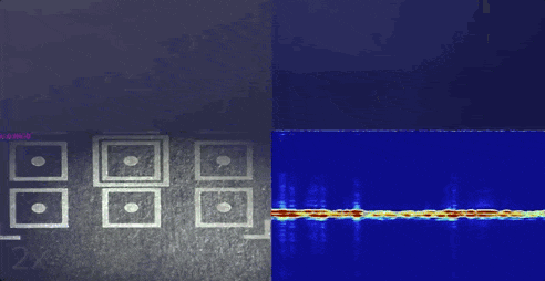 🧠 Elon's Neuralink Update