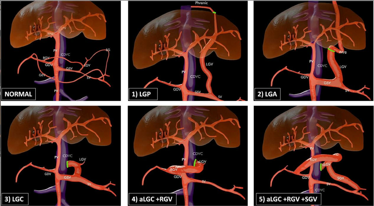 A PSS classification system