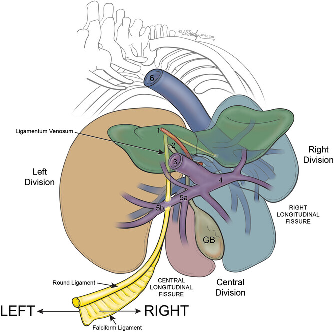 Interlobar vs. intralobar intrahepatic shunts