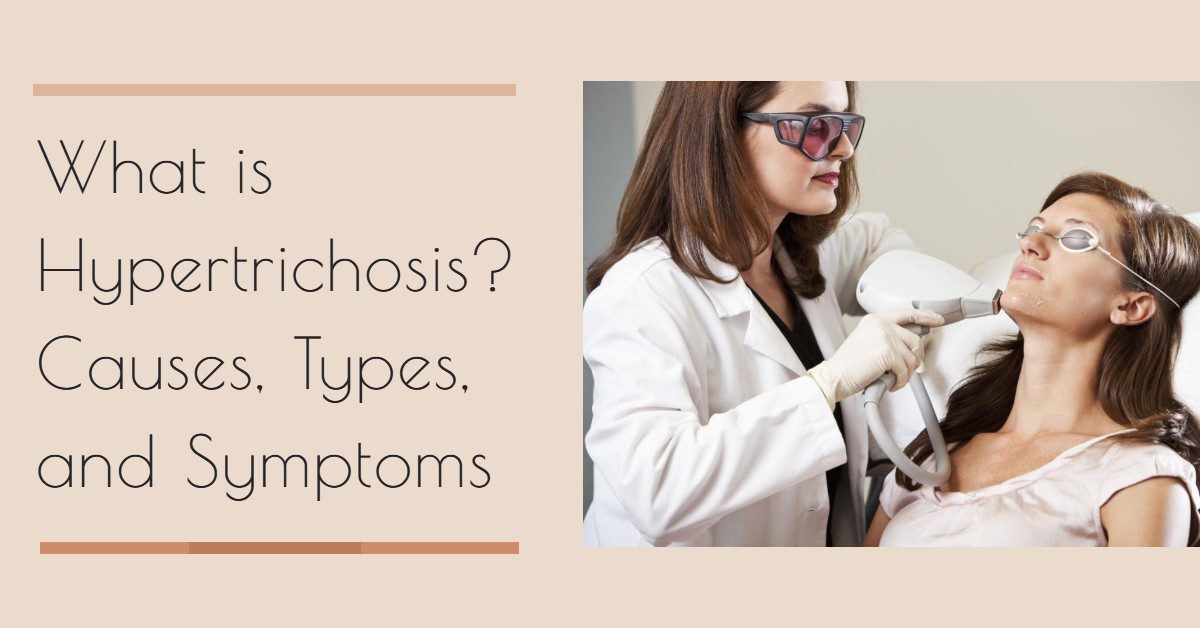 What is Hypertrichosis? Causes, Types, and Symptoms