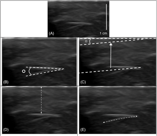 Ultrasound of dogs with swollen toes