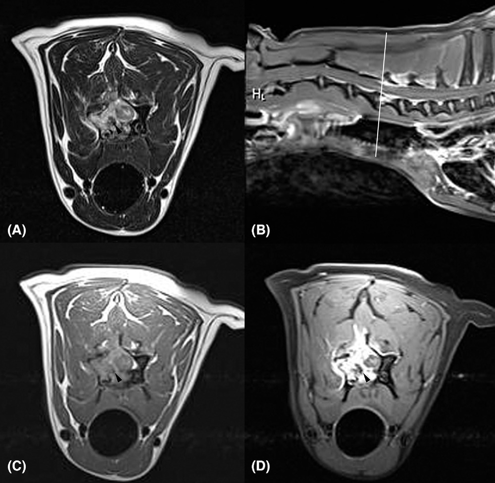 What does axial skeleton osteosarcoma look like on MRI?