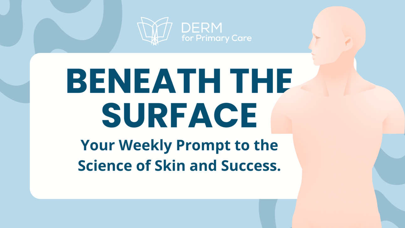 Understanding Seborrheic Dermatitis: Causes, Symptoms, and Treatments