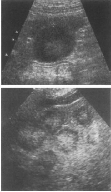Do target lesions = cancer?