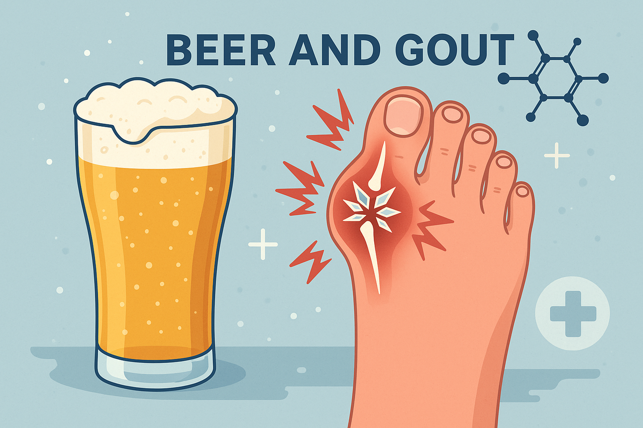 Low-Purine Beers for Gout: Safe Choices Backed by Science