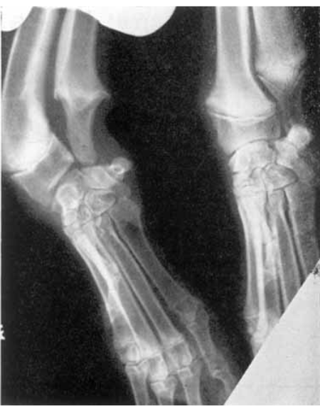 Normal and abnormal bone growth in the dog