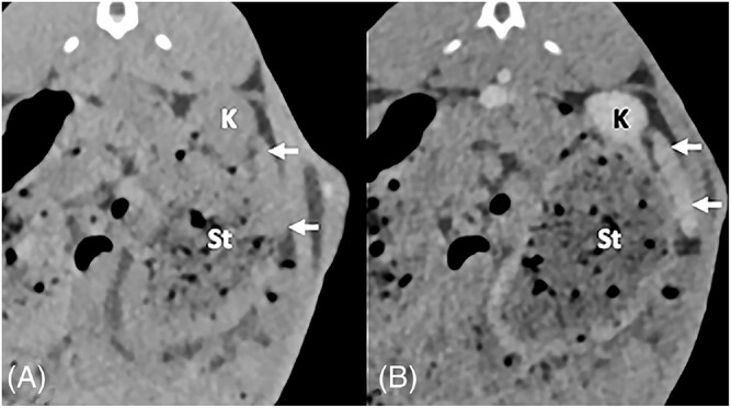 Normal CT appearance of the spleen in rabbits.
