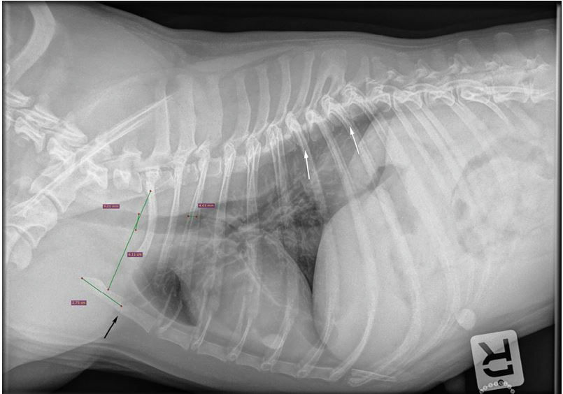 Do we need a different cut-off for Frenchy normal trachea size?