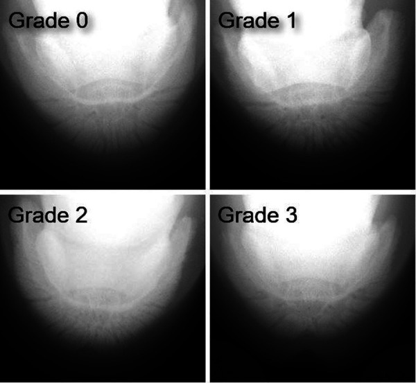 Is the crena marginalis normal?