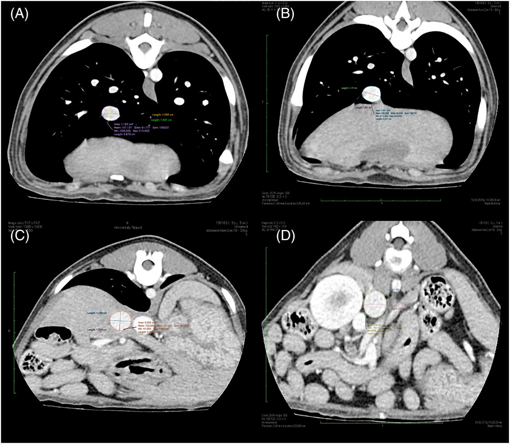 Is there a consistent way to measure the CVC size?