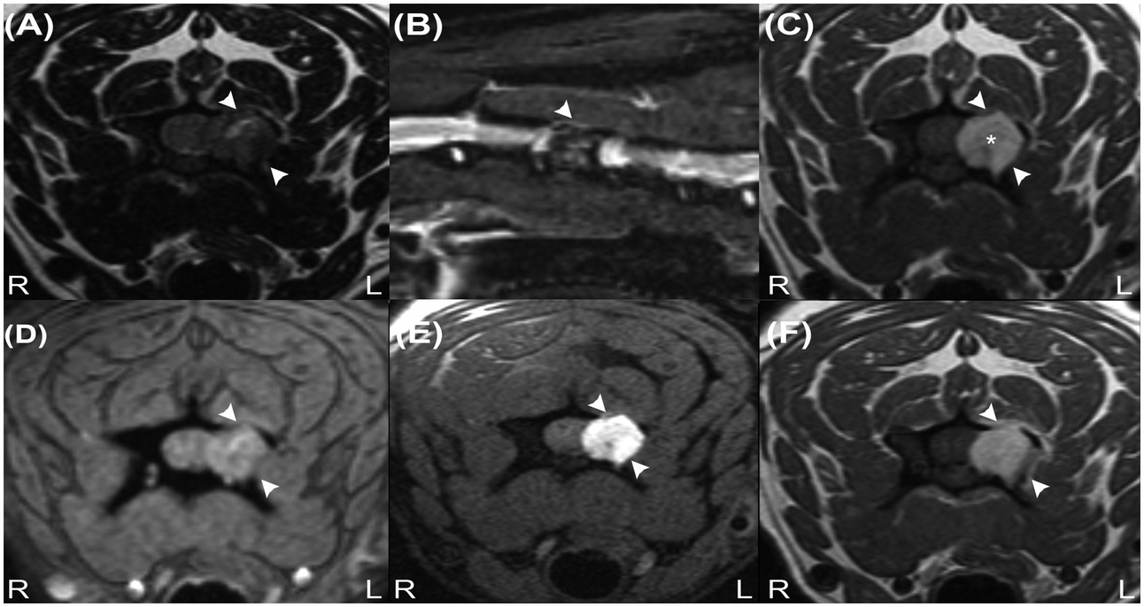 Review of differentials for T1 hyperintense lesions