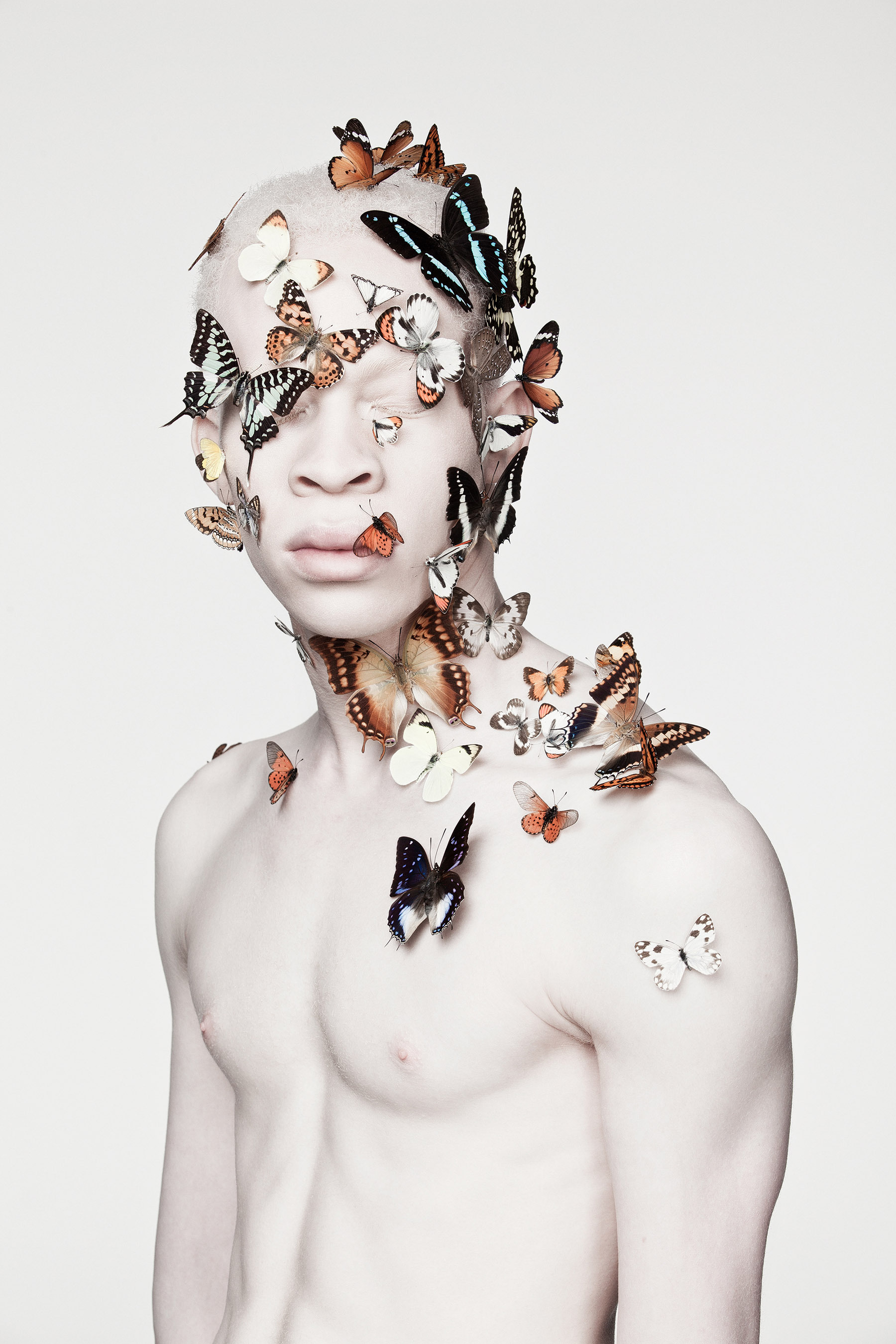 Striking Photos of African Albinism