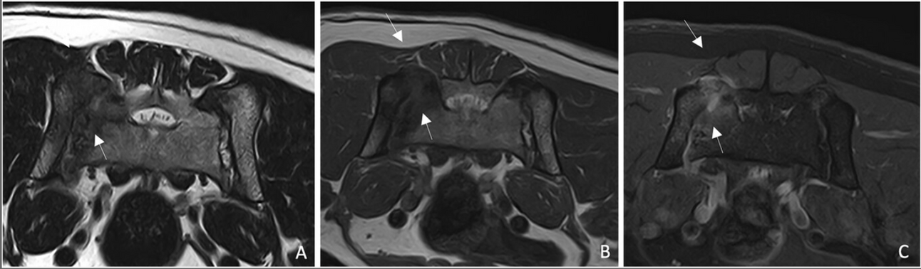 MRI Insights into Unilateral Sacroiliitis in a German Shepherd
