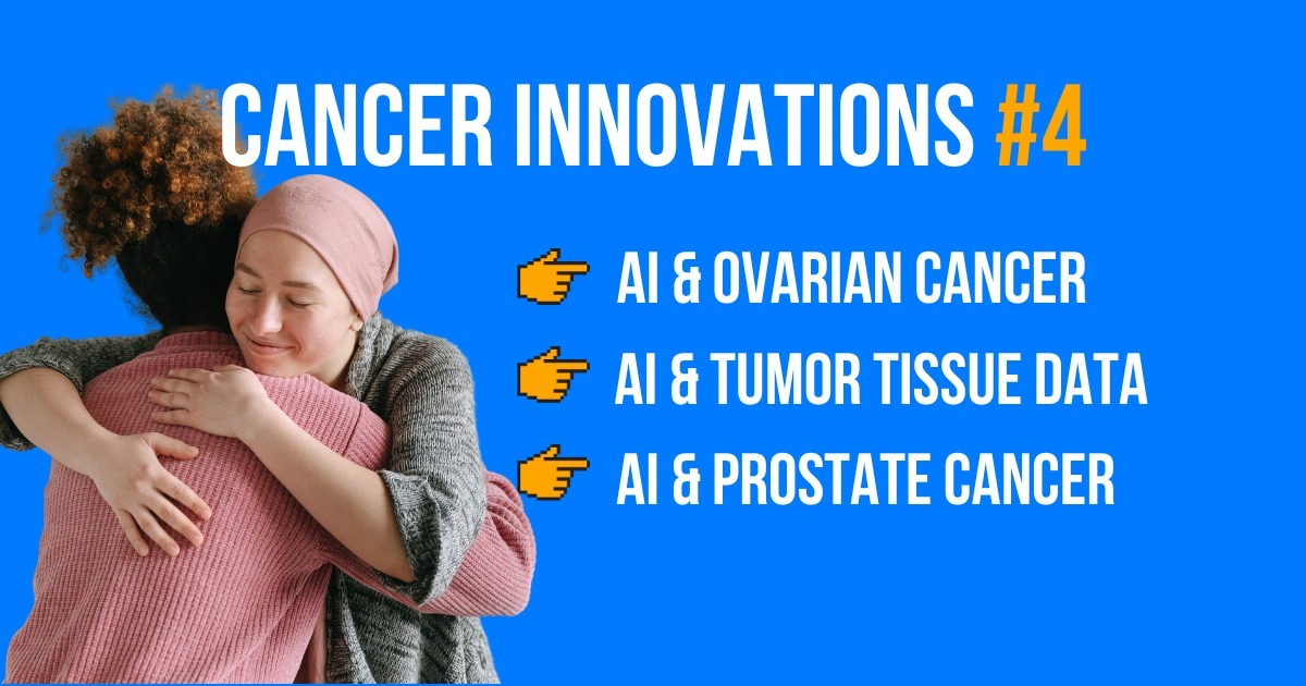 AI tool predicts 80% of ovarian cancer therapy outcomes