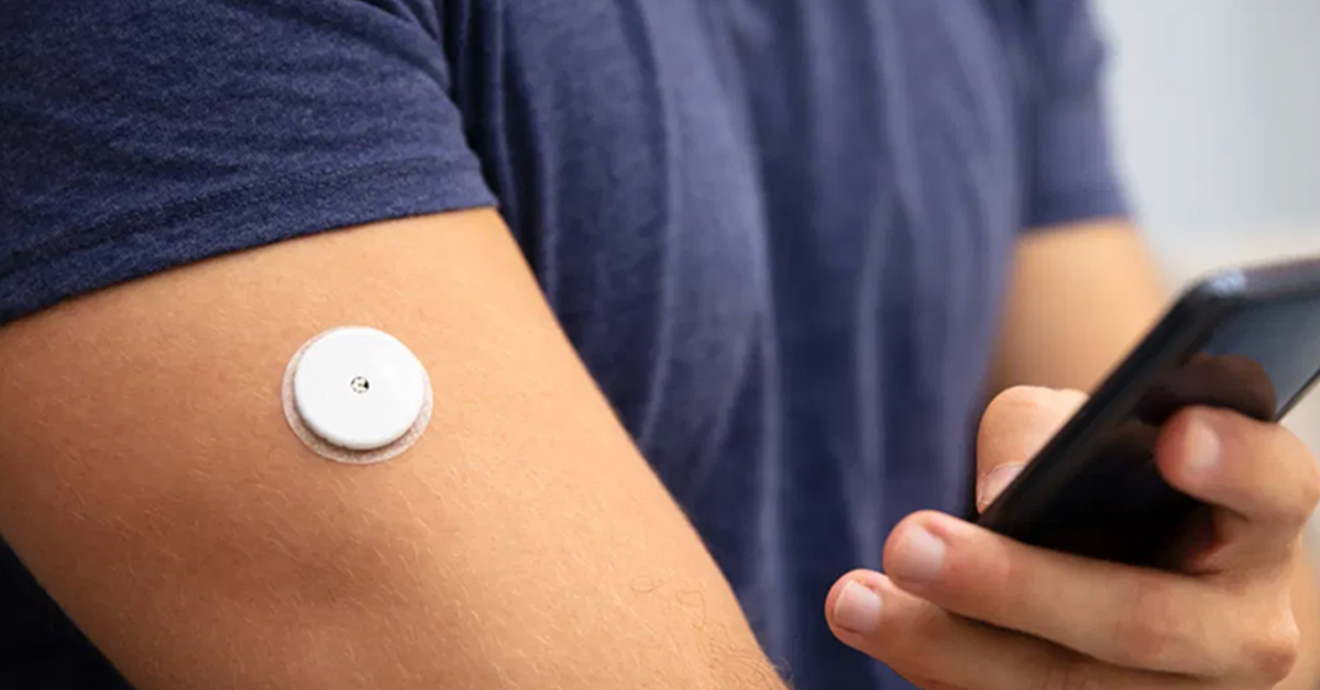 Continuous Glucose Monitors (CGM) 101
