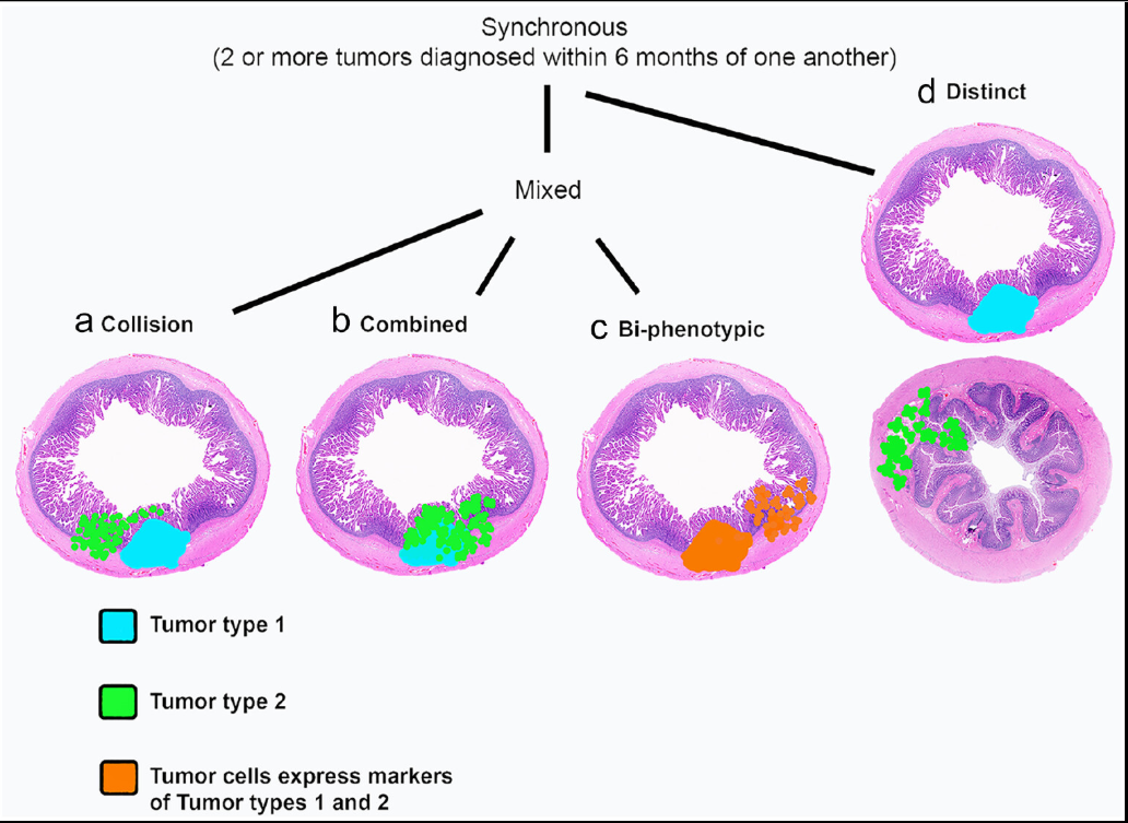 First-Ever Classification of Dual GI Cancers in Cats Shows Prognosis ...