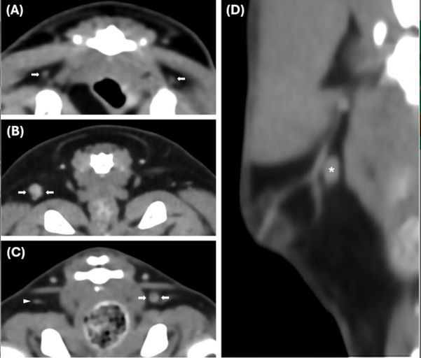 New CT Insights into Feline Ischiatic Lymph Nodes: Multicenter Study on ...