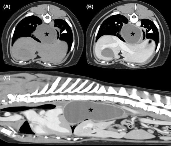 Novel Thoracoscopic Approach Resolves Rare Mediastinal Abscesses in ...