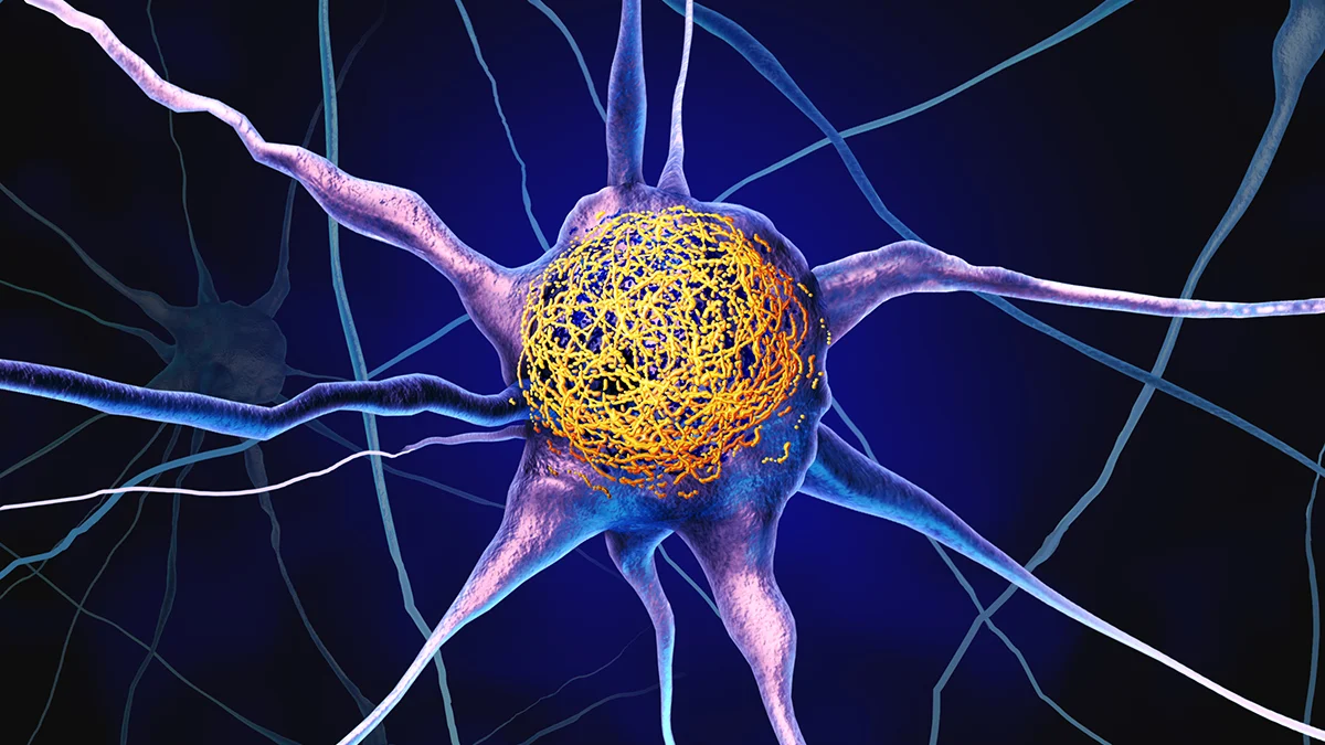 A Vitamin Linked to Alzheimer's Tangles