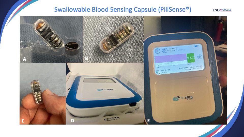 Technical Review Pillsense ® A Novel Swallowable Capsule To Detect Upper Gastrointestinal Bleeding
