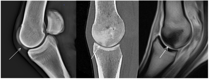 Imaging of the normal fetlock in 40 non-lame thoroughbred yearlings