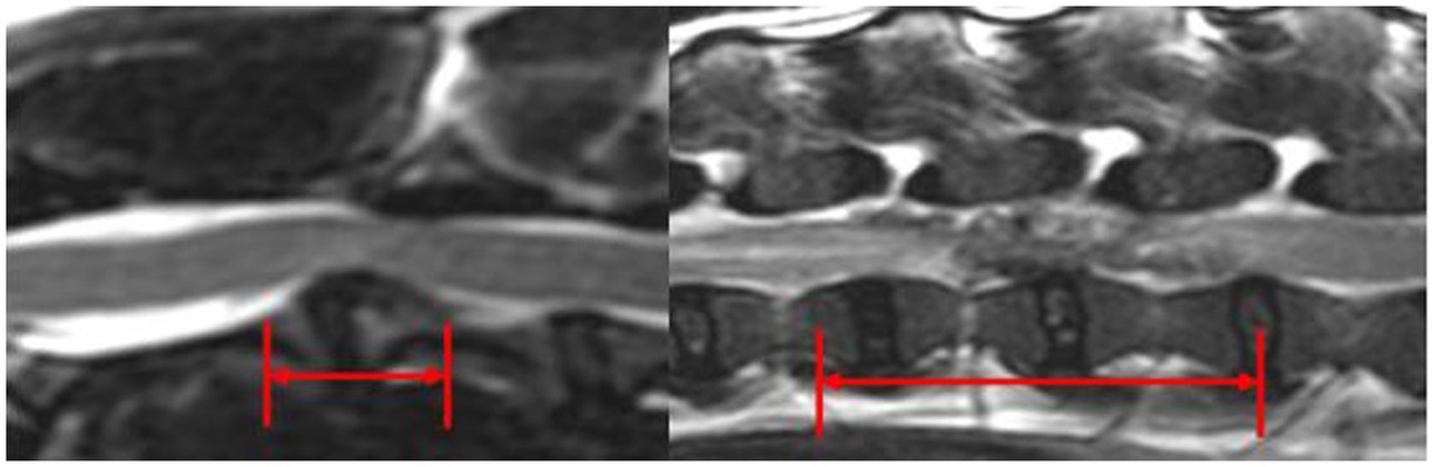 MRI of Frenchie disc disease