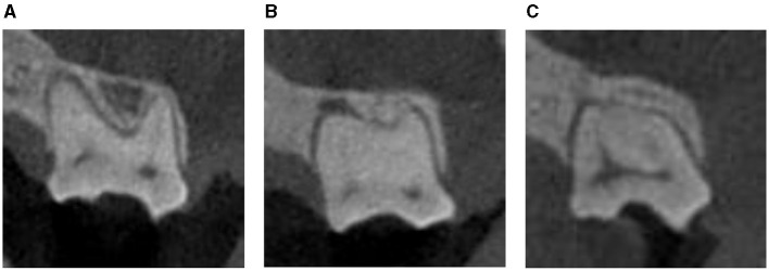 Variation in fused molar roots in dogs