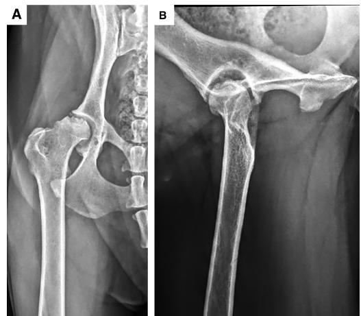 OCD happens on the femoral head too in dogs