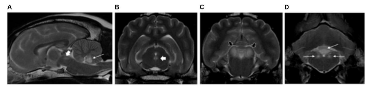 Pattern recognition on MRI...