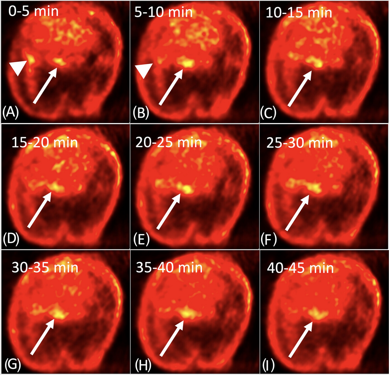 How to PET scan the equine foot