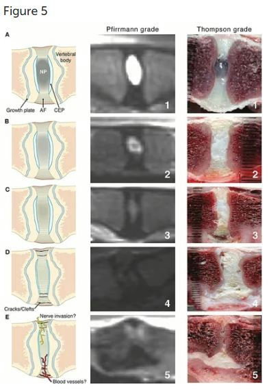 Imaging review for Intervertebral disc disease from Canine Spinal Cord ...