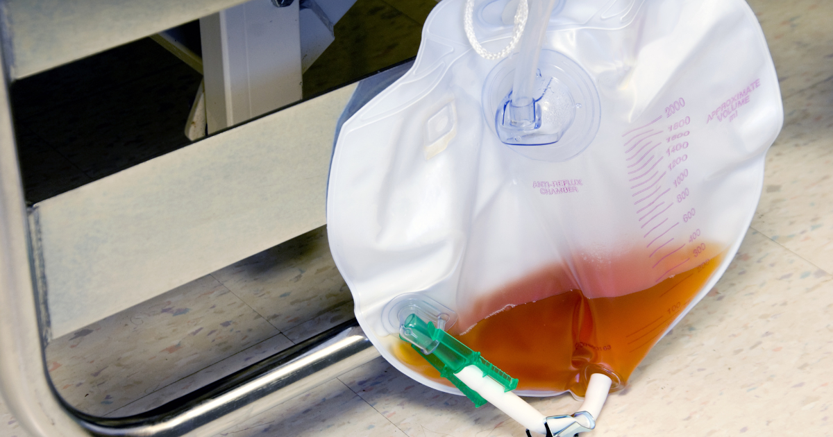 Foley Catheter Patient