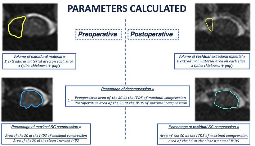 How much disc is left post surgery?