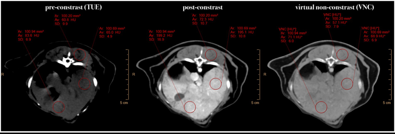 Better Imaging, Less Stress: Virtual Non-Contrast CT Proves Effective ...