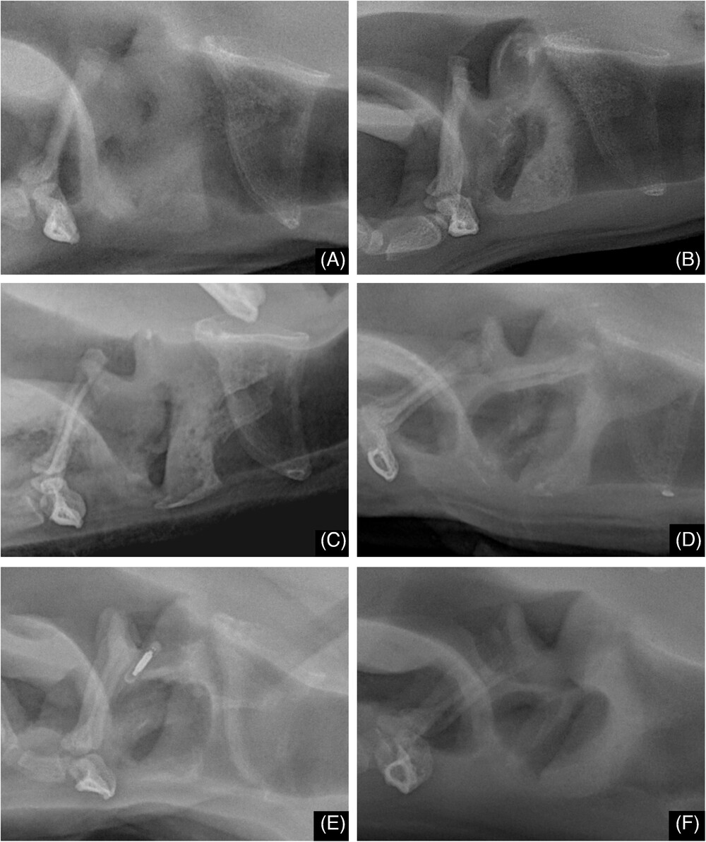Laryngeal Radiography: A Non-Invasive Screening Tool for Diagnosing ...