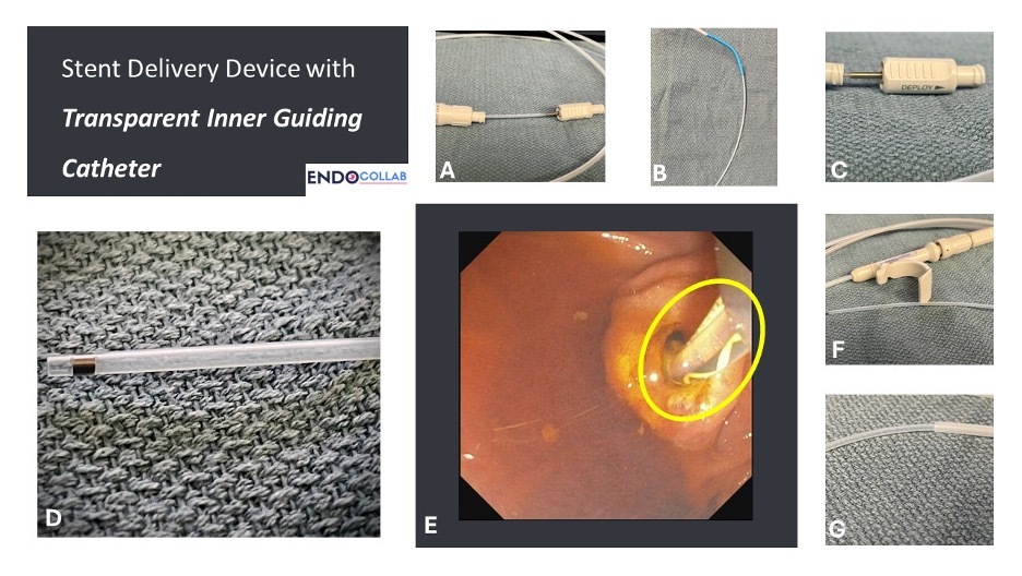 Stent Delivery Device with Transparent Inner Guiding Catheter and How ...