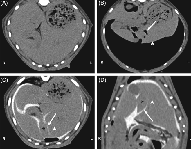 Positive contrast CT peritoneography, ever done it on a clinical patient?