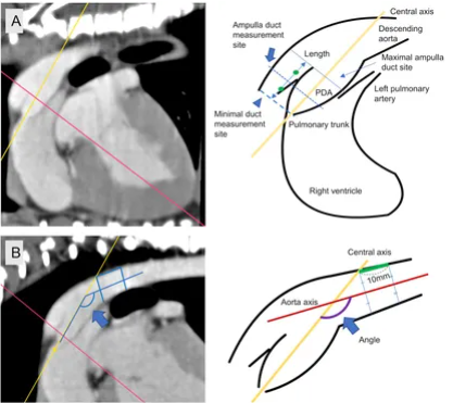 Do you know your PDA type?